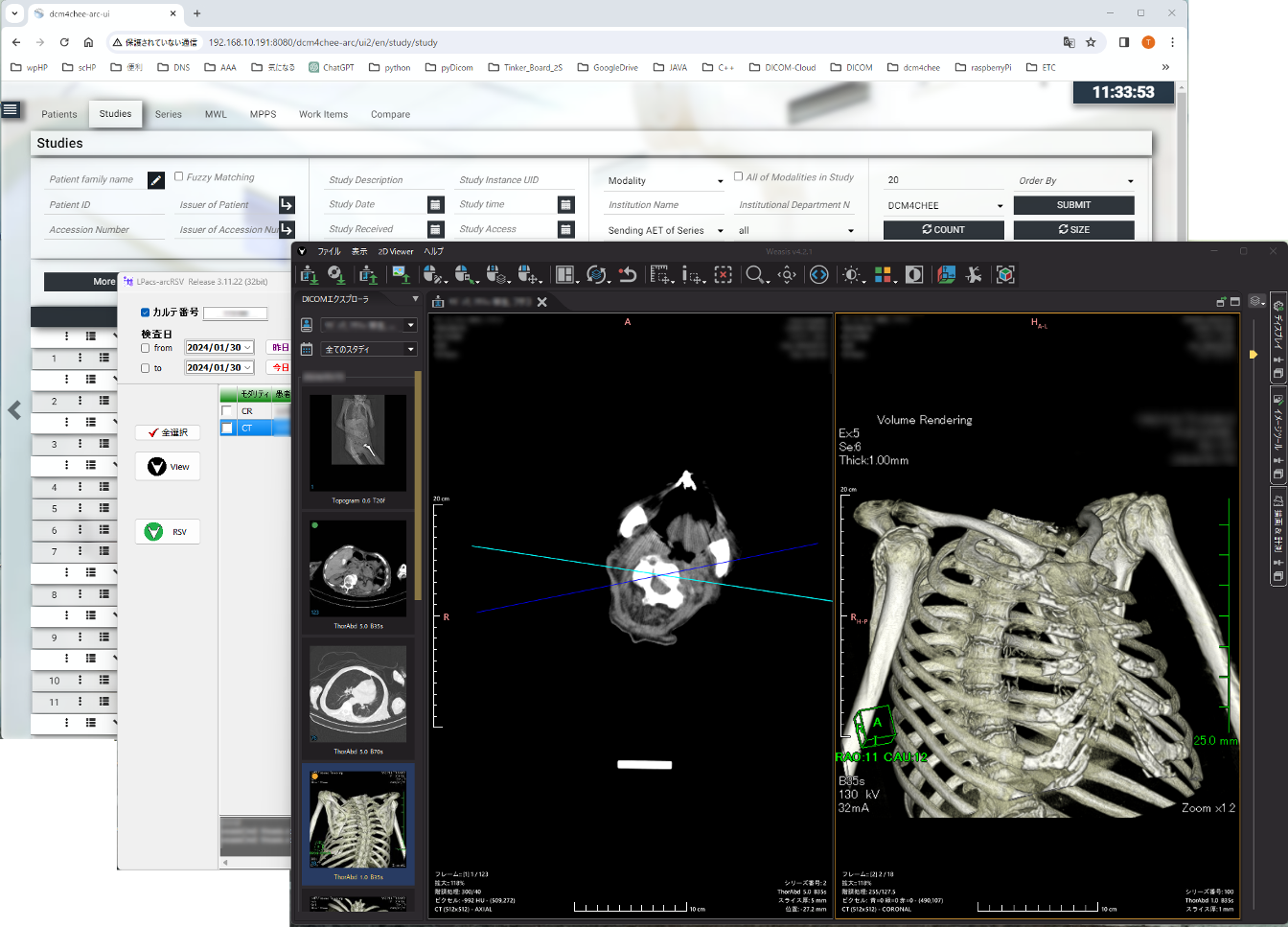 dcm4chee-arc-light 5.31.2 + Weasis | システムクラフト